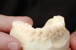 Modern Dental Laboratory Canada | Dental Lab Vancouver