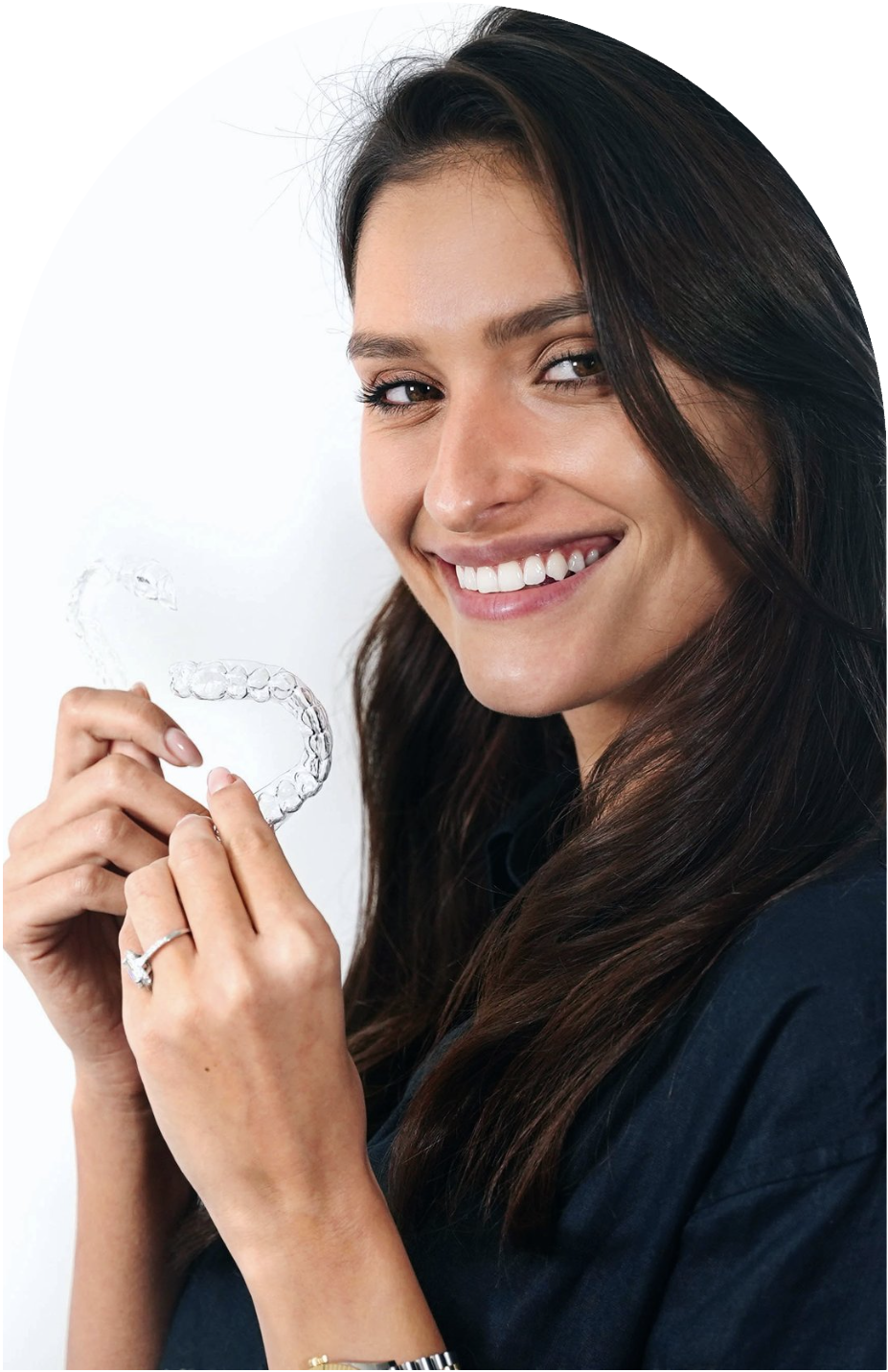 TrioClear Aligner - Modern Dental Lab Canada